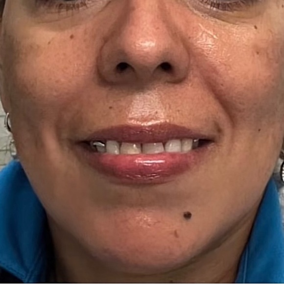 CT+ | Skincare | Ct Clear Therapy Lotion 50ml Beauty Bar 75g Serum ...